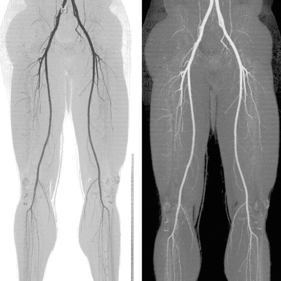 Upper and Lower Limb Imaging | SpringerLink