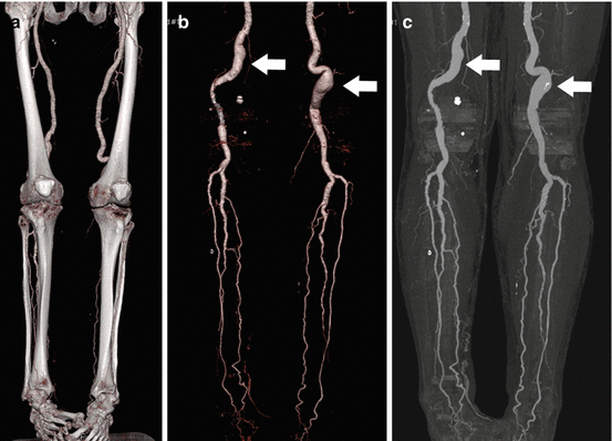 Upper and Lower Limb Imaging | SpringerLink