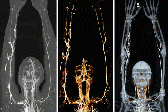 Upper and Lower Limb Imaging | SpringerLink