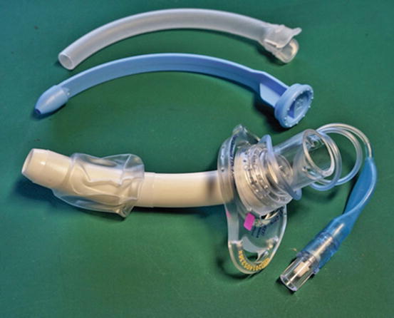 Tracheostomy Tube | SpringerLink