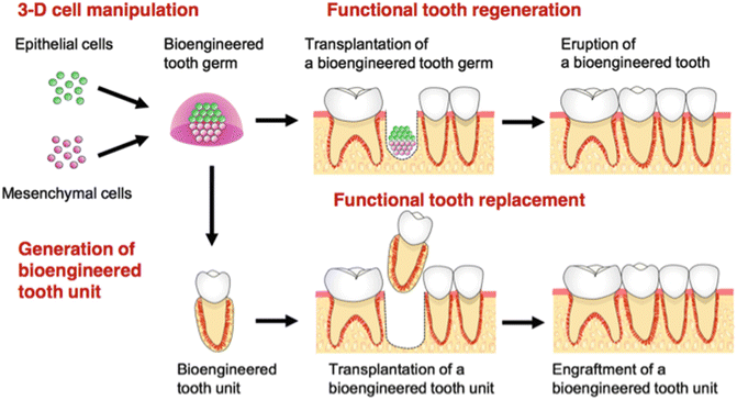 Whole Tooth Regeneration as a Future Dental Treatment | SpringerLink