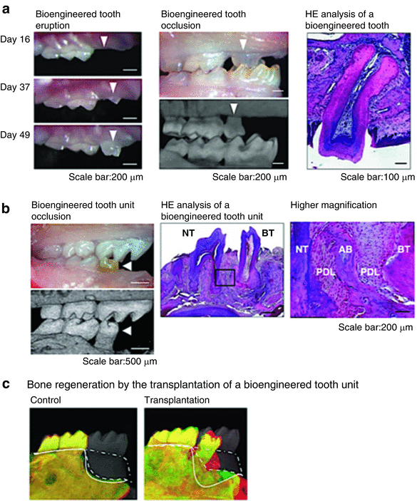 Whole Tooth Regeneration as a Future Dental Treatment | SpringerLink
