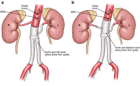 Operative Strategies | SpringerLink