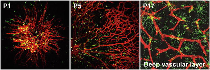 Retinal Vascular Development | SpringerLink