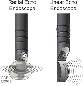 Interventional Endoscopic Ultrasound | SpringerLink