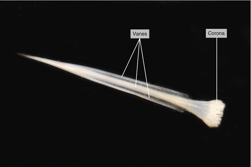 Dissection of a Snail ( Helix pomatia) | SpringerLink