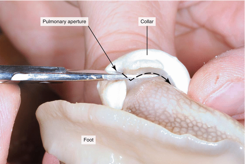 Dissection of a Snail ( Helix pomatia) | SpringerLink