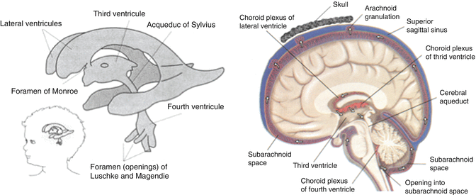 Extraventricular Drains and Ventriculostomy | SpringerLink