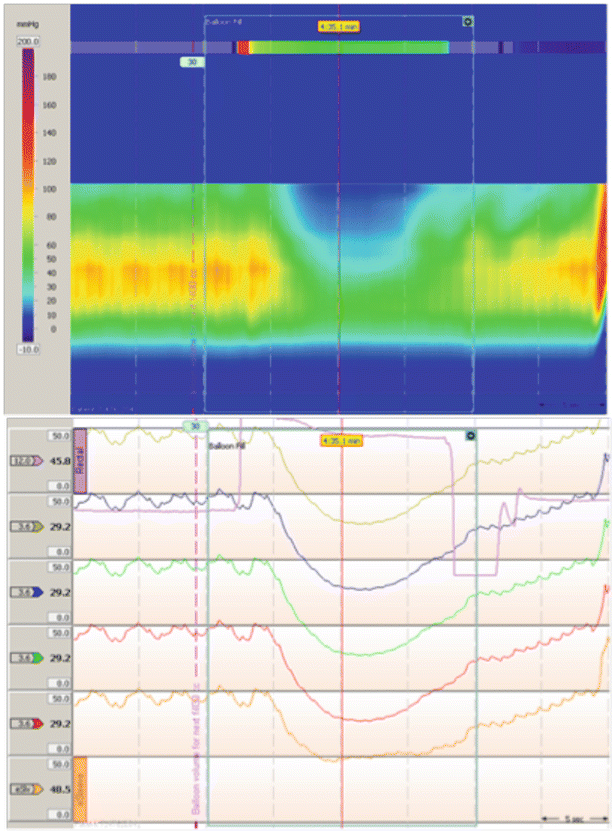 Common Tests for the Pelvic Floor | SpringerLink