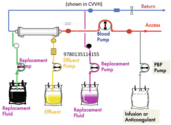 Continuous Renal Replacement Therapy (CRRT) | SpringerLink