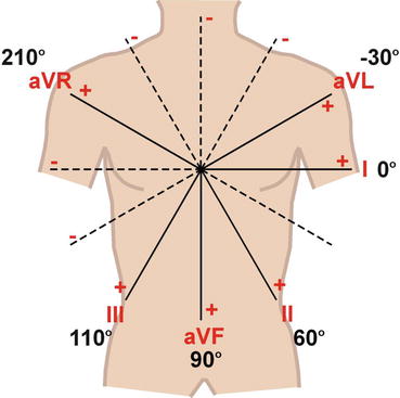 Cardiac Axis: Calculation and Interpretation | SpringerLink