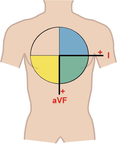 Cardiac Axis: Calculation and Interpretation | SpringerLink