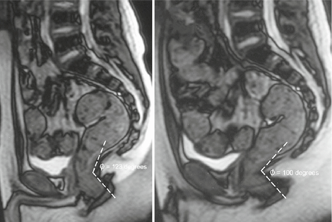 Anorectum | SpringerLink