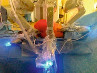 Robotic Ventral Hernia Repair | SpringerLink
