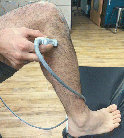 Lateral Sural Cutaneous Nerve Entrapment | SpringerLink