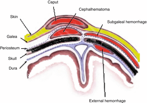Surgery of the Scalp | SpringerLink