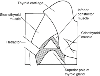 External Branch of Superior Laryngeal Nerve (EBSLN) Anatomic ...
