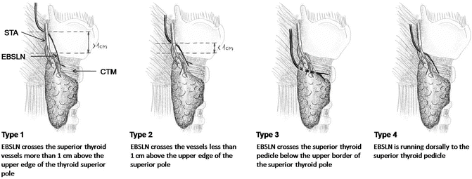 External Branch of Superior Laryngeal Nerve (EBSLN) Anatomic ...