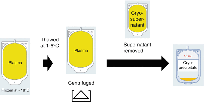 Cryoprecipitate Transfusion | SpringerLink
