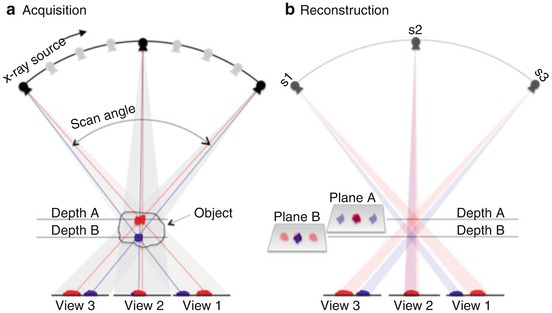 Physics and Radiation Dose of Digital Breast Tomosynthesis | SpringerLink