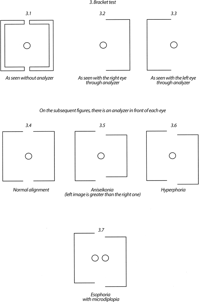 Polatest Procedure | SpringerLink