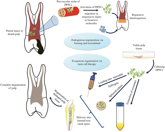 Dental Pulp Stem Cells in Tissue Engineering and Regenerative Medicine ...
