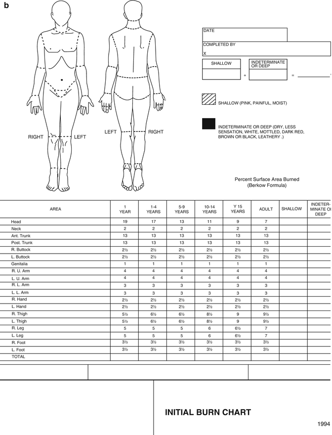 Burns in Children | SpringerLink