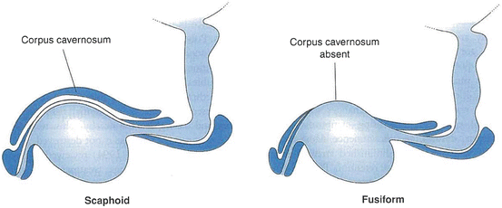 Congenital Anomalies of the Urethra | SpringerLink
