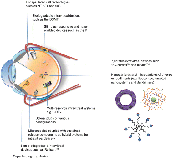 Intraocular Drug Delivery Technologies: Advancing Treatment of ...