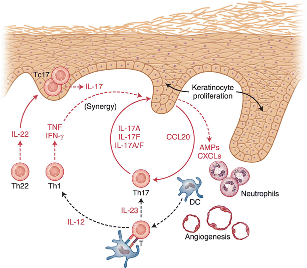Biologic Therapies for Psoriasis | SpringerLink