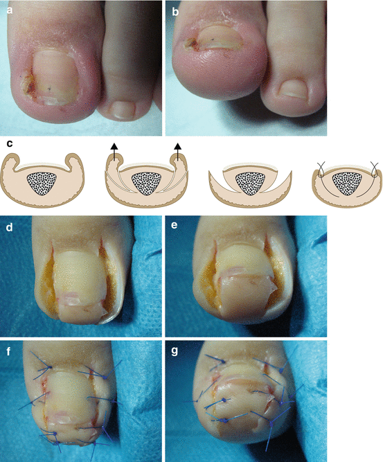 Surgical Treatment | SpringerLink