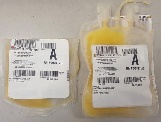 Blood Components | SpringerLink