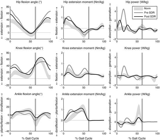 Interpreting Joint Moments and Powers in Gait | SpringerLink