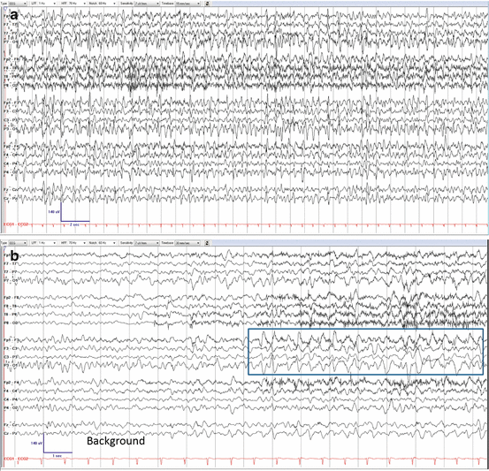 Patterns of Uncertain Significance | SpringerLink
