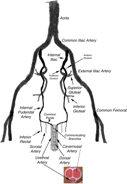 Endovascular Approaches to Penile Arterial Revascularization for ...