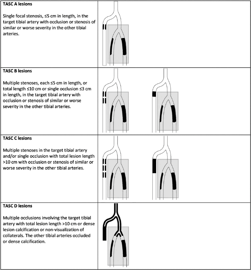Classification Systems for Acute and Chronic Limb Ischemia | SpringerLink