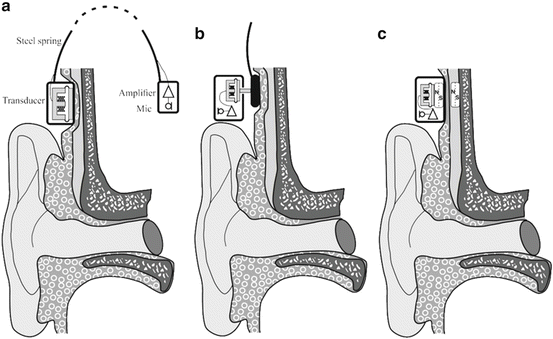 Hearing Aid Transducers | SpringerLink
