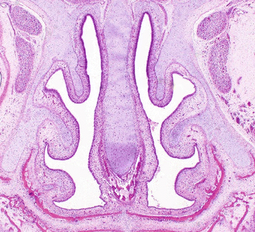 Sinonasal Tract – Anatomy and Histology | SpringerLink