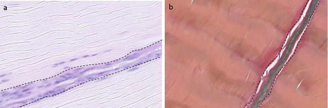 Tendon Structure and Composition | SpringerLink