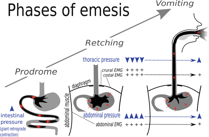 The Physiology of Vomiting | SpringerLink