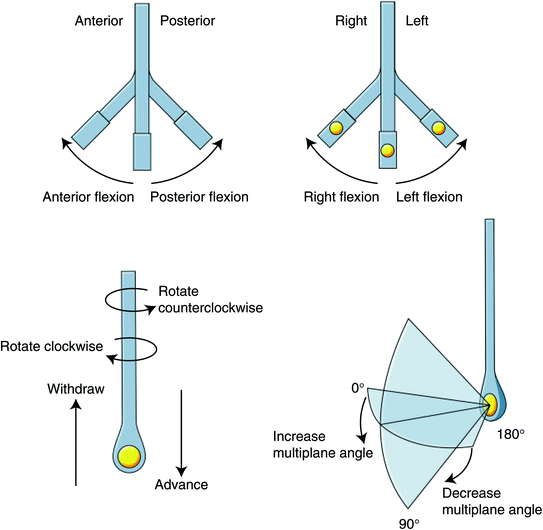 TEE in Non-cardiac Surgery: Indications, Contraindications, Probe ...