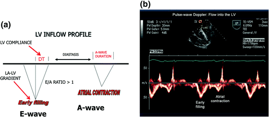 Diastology | SpringerLink