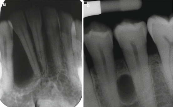 Common Lesions in Oral Pathology for the General Dentist | SpringerLink