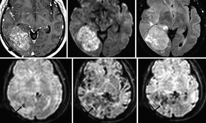 Choroid Plexus: Normal Locations and Appearances | SpringerLink