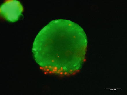 Isolation of Mouse Pancreatic Islets of Langerhans | SpringerLink