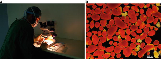 Clinical Islet Isolation | SpringerLink