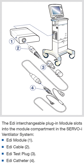 SERVO-i Ventilator and NAVA | SpringerLink
