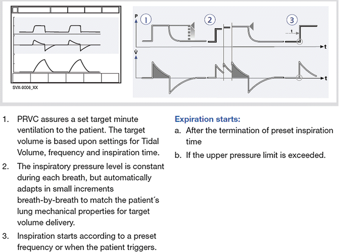 SERVO-i Ventilator and NAVA | SpringerLink