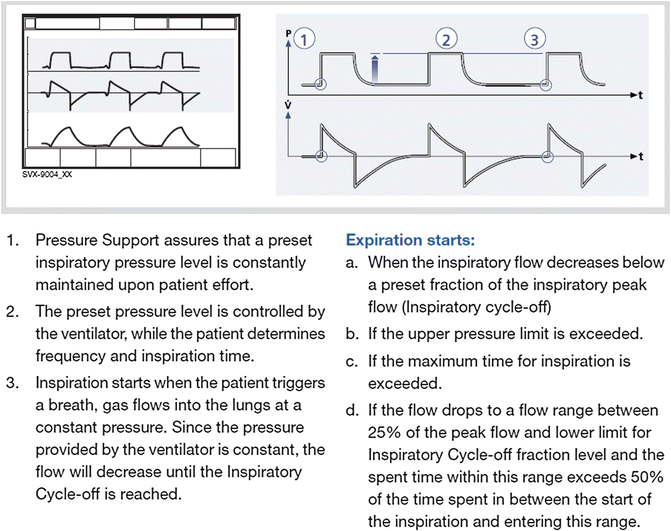 SERVO-i Ventilator and NAVA | SpringerLink