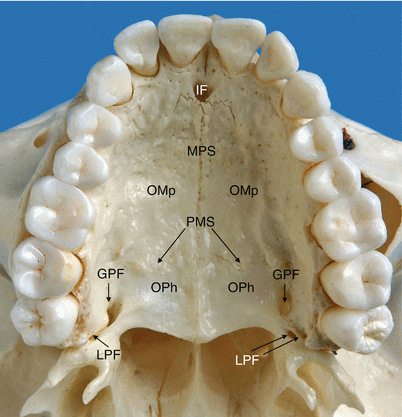 Hard and Soft Palate | SpringerLink